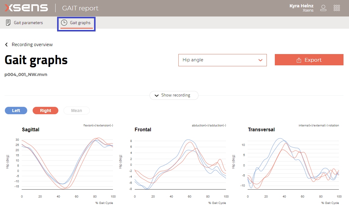 Gait Report - How to interpret data?