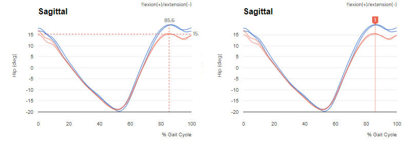 Gait Report - How to interpret data?