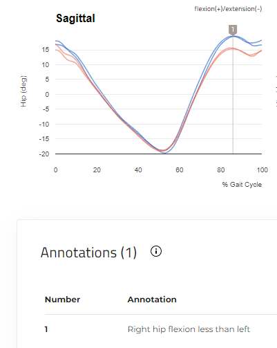 Gait Report - How to interpret the data?